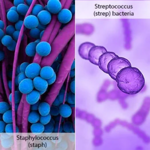 14 Differences Staphylococcus And Streptococcus Bacteria [American ...