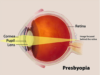 Difference Between Myopia, Hypermetropia And Presbyopia (With Diagram ...