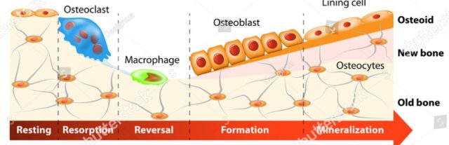 12 Difference Between Osteoblasts And Osteoclasts (With Pictures ...