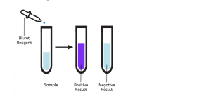 Biuret Test: Principle, Reagent & Result Interpretation - VIVA DIFFERENCES